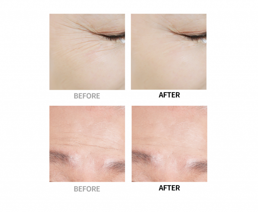 Korea Dermaline PDX5 Exosome Skin Booster Complex | Salmon DNA