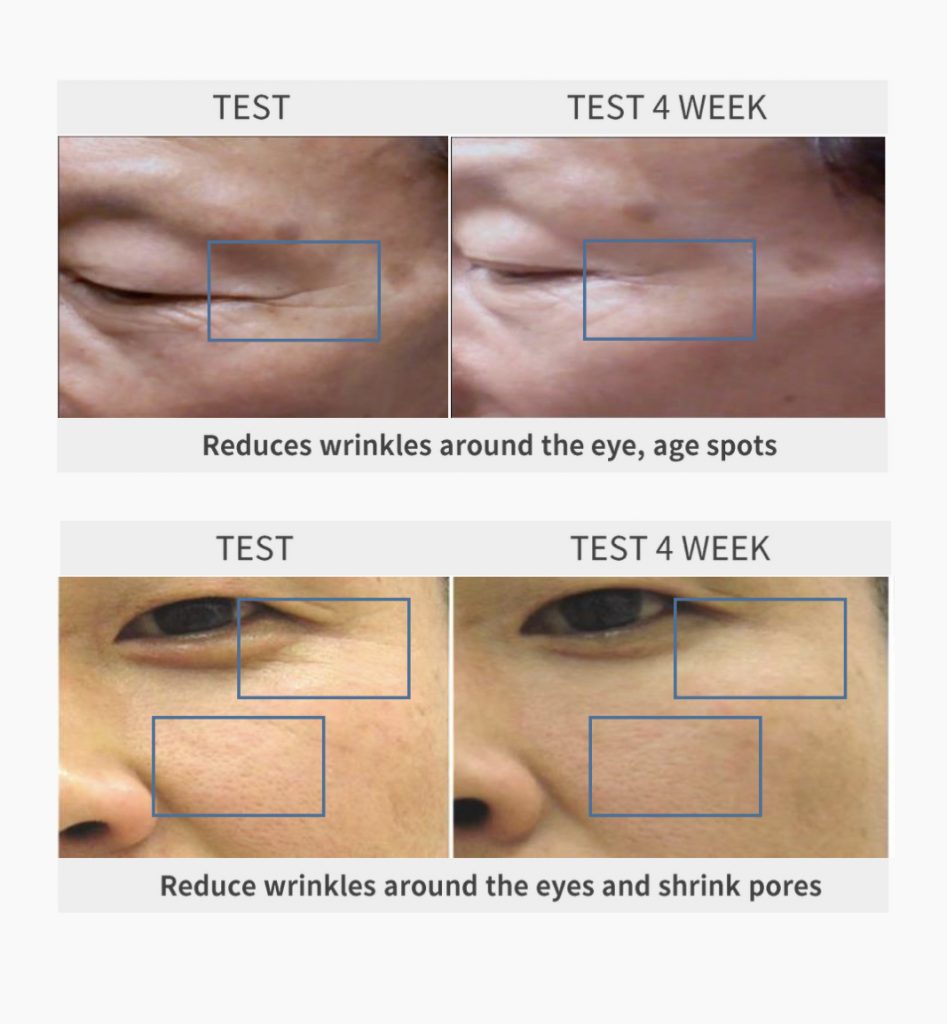 Dermaline PDX4 Exosome & PDRN SKin Booster REVITALIZING