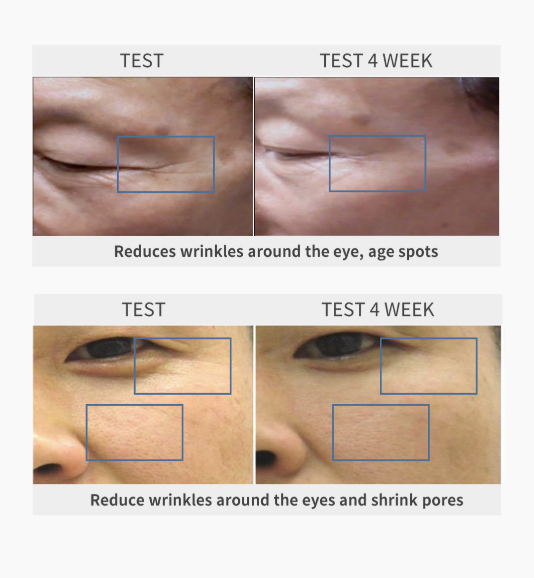 Dermaline PDX4 Exosome & PDRN SKin Booster REVITALIZING